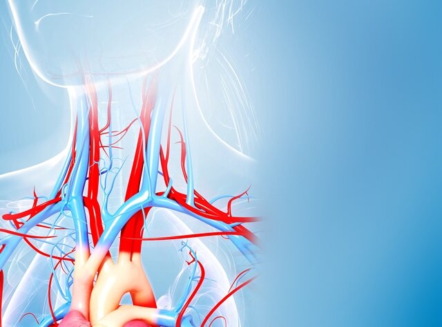 Diagnose verengte Halsschlagader